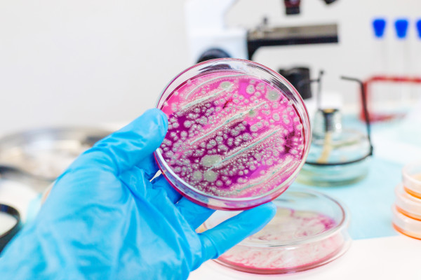 Dechallenge and Rechallenge for Proving Drug Causality - DrugCard ...